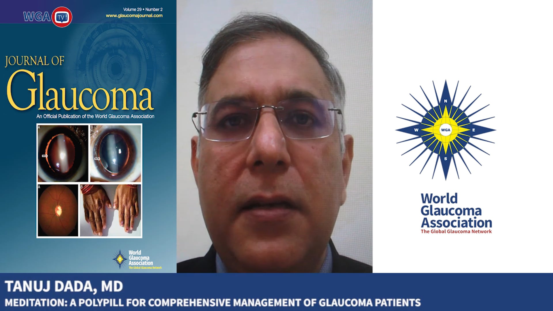 World Glaucoma Association February 2020 - WGA Journal of Glaucoma ...