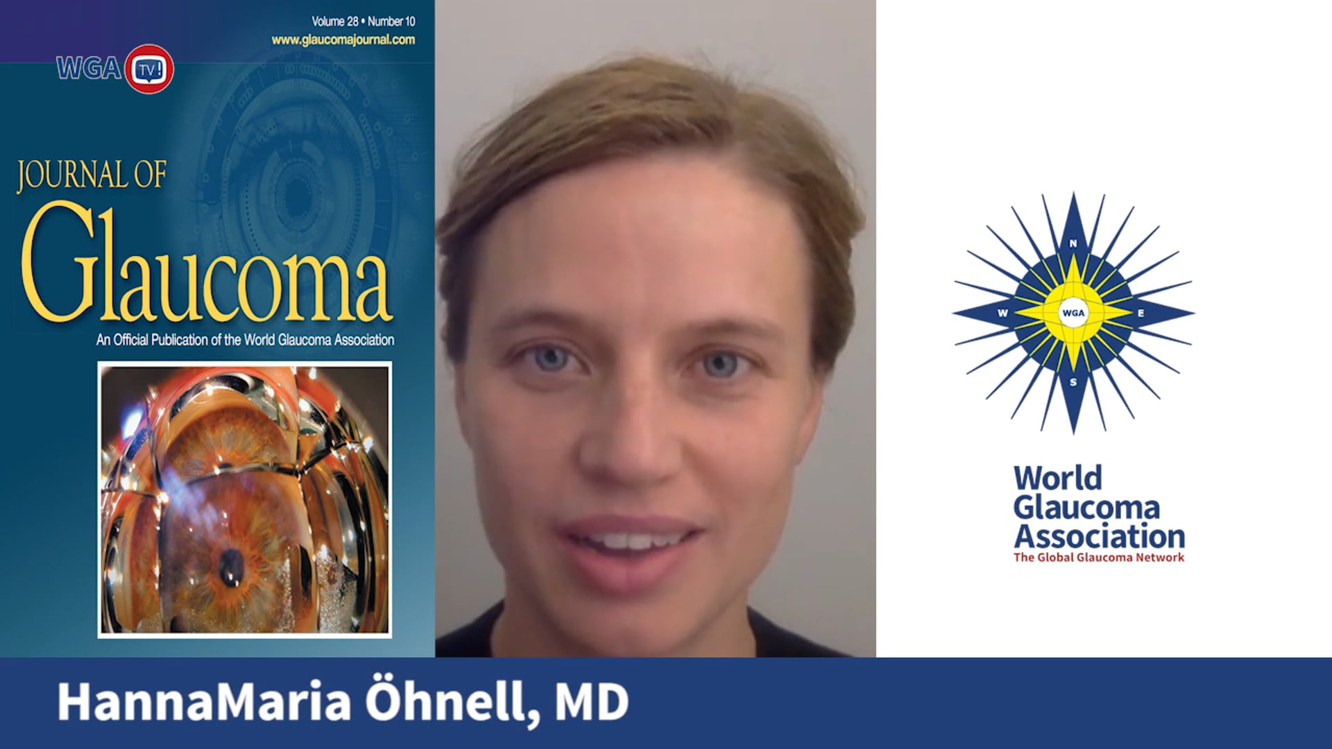 World Glaucoma Association October 2019 - WGA Journal of Glaucoma Paper ...
