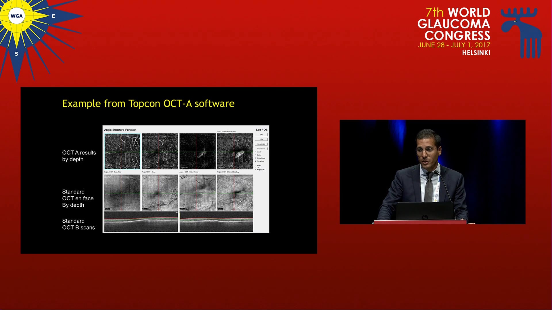 World Glaucoma Association Principles and scanning protocols of OCT ...